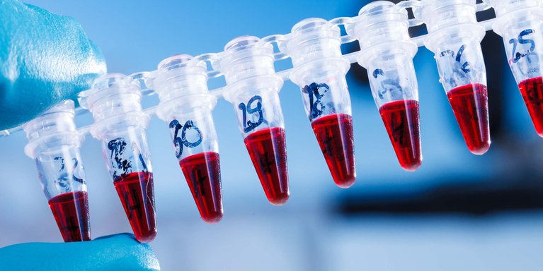 ¿Qué son los biomateriales y cuáles son sus aplicaciones? | Blog UE