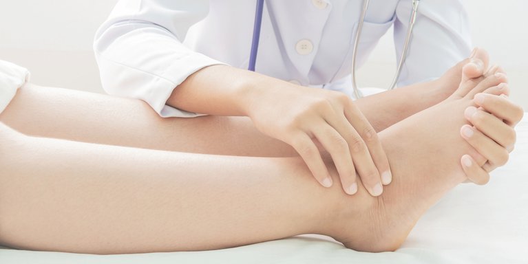 ¿Qué es un edema? | Blog UE