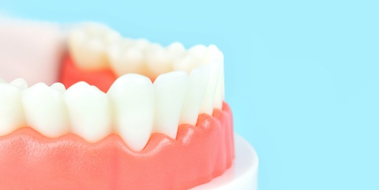 ¿Qué es el raspado y alisado radicular? | Blog UE